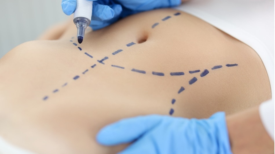 La seguridad del paciente quirúrgico y su importancia | UNIR